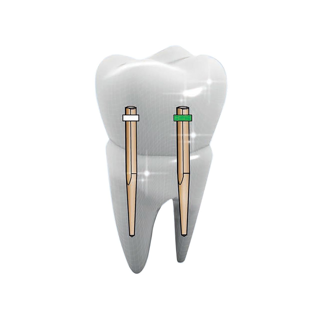 TENONS PEEK-OPTIMA | MEGA Dental